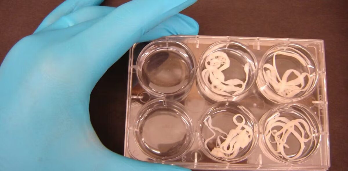 Brown Intestinal Worms In Toilet: What You Must Know - Home Briefings